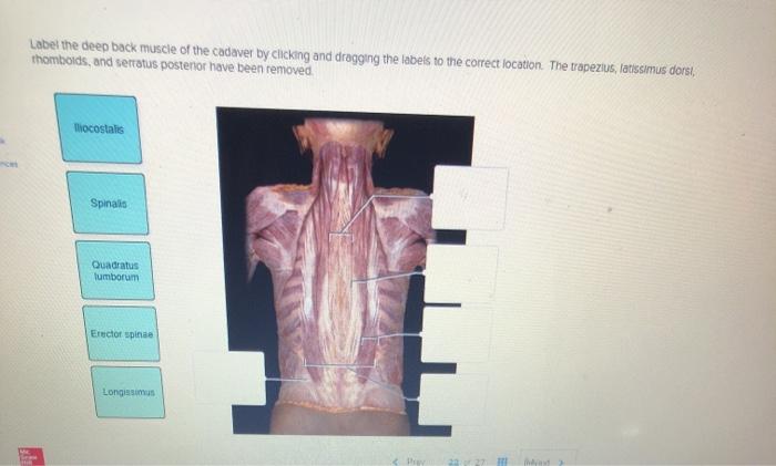 Solved Label The Deep Back Muscle Of The Cadaver By Clicking