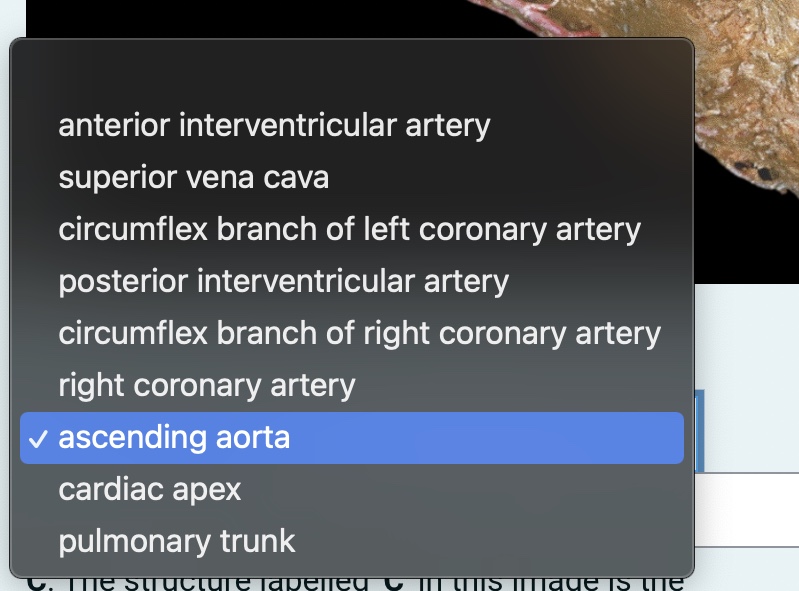 Solved anterior interventricular arterysuperior vena | Chegg.com