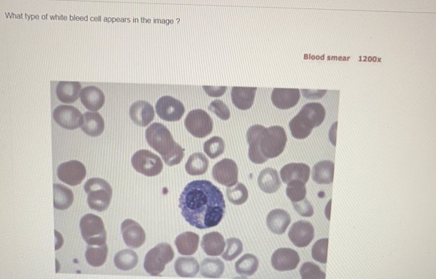 Solved What type of white bleed cell appears in the image | Chegg.com