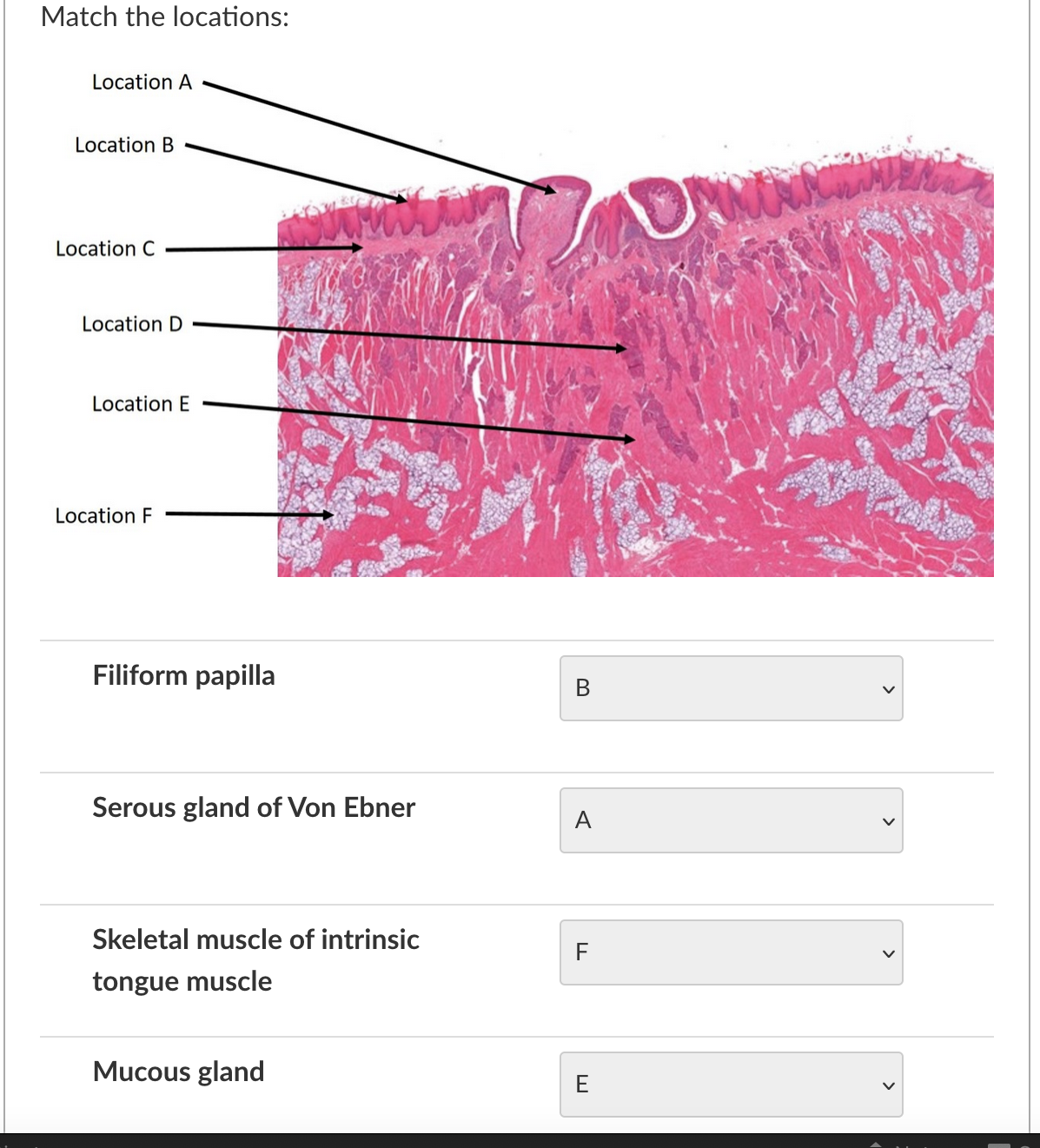 Solved Match the locations:Filiform papillaSerous gland of | Chegg.com