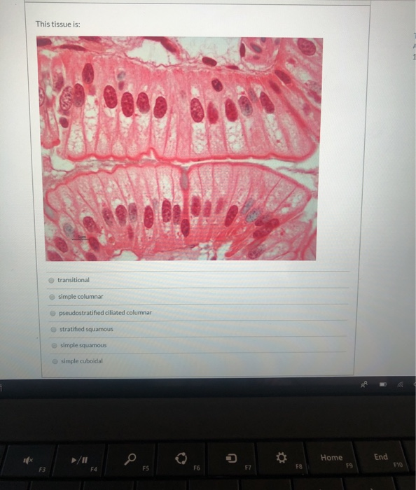 Solved This tissue is: transitional simple columnar | Chegg.com