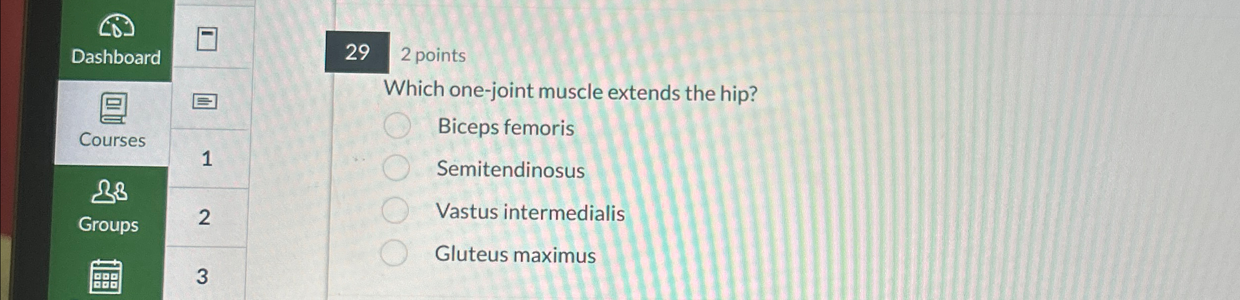 Solved 292 pointsWhich one-joint muscle extends the | Chegg.com Solved 292 pointsWhich one-joint muscle extends the | Chegg.com