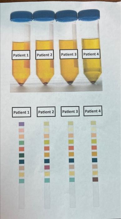 Urinalysis Case Study Case 1 - 23 year old pregnant | Chegg.com