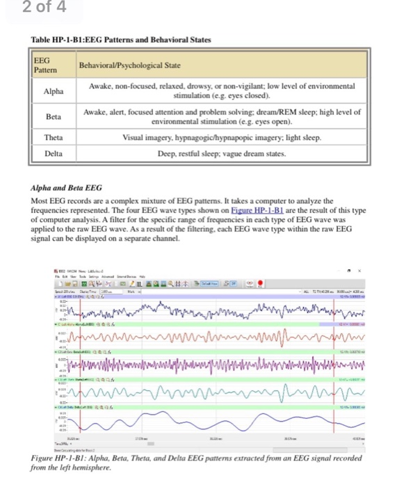 Lab 7: EEG and Sleep Note: Please read the EEG | Chegg.com