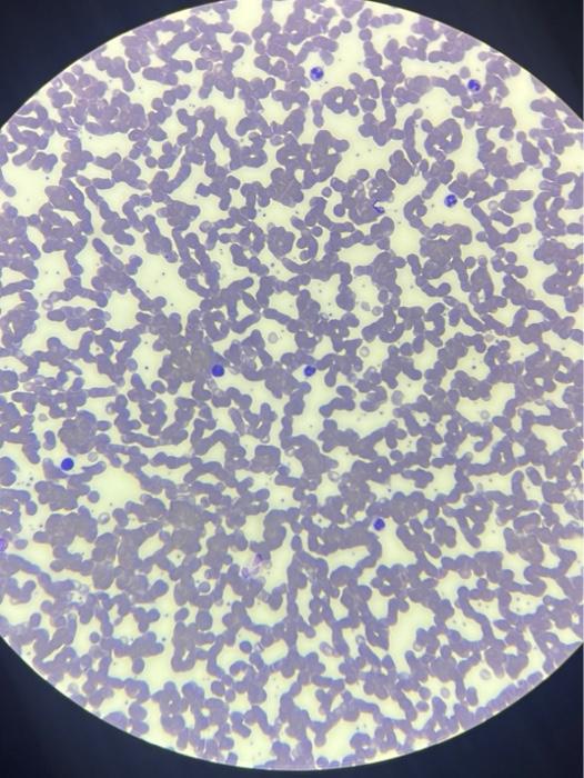 Solved Label the two blood slides please | Chegg.com