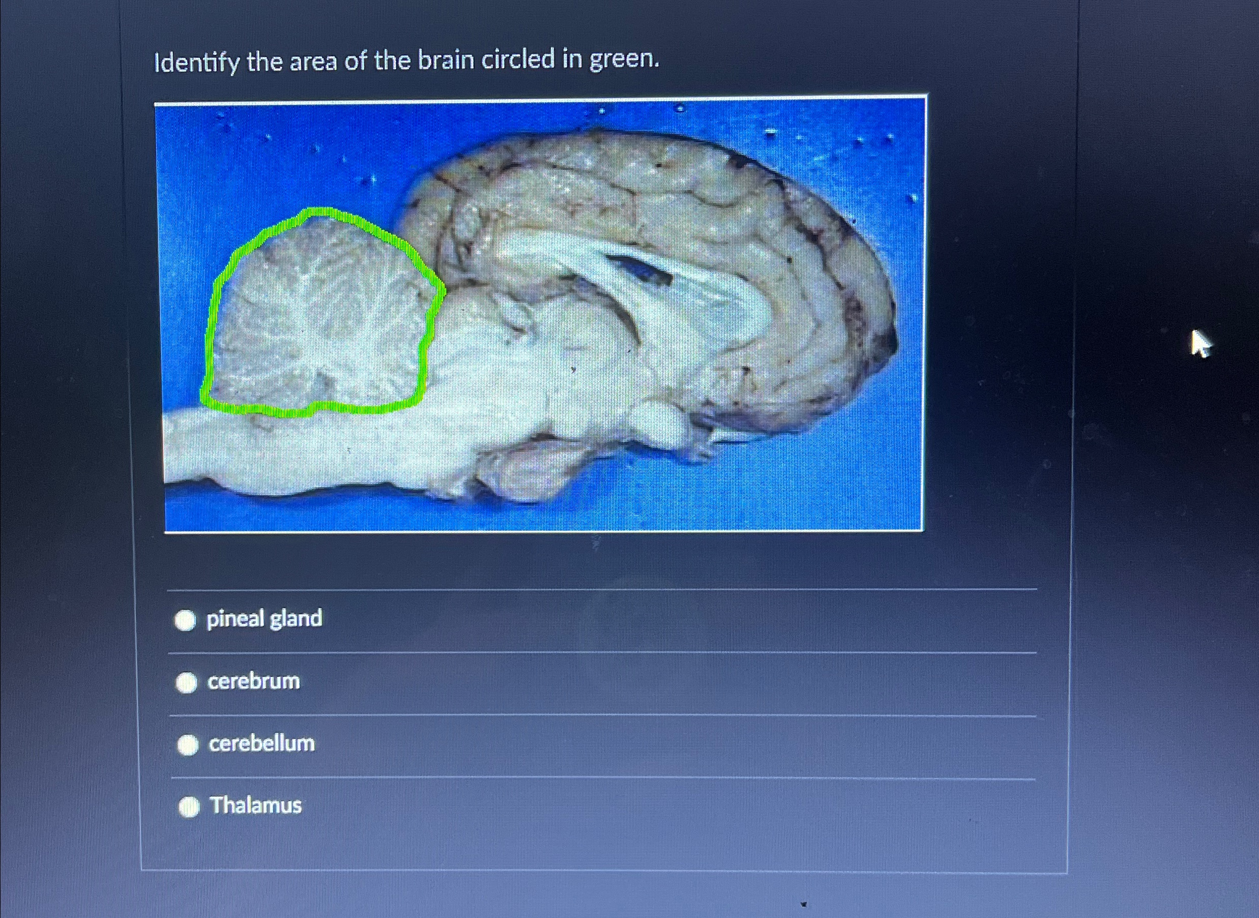 Solved Identify the area of the brain circled in | Chegg.com