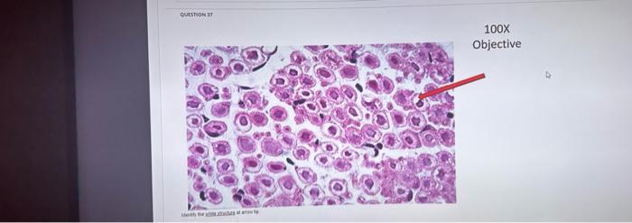 Qutsाowมn 100X ObjectiveObjective | Chegg.com