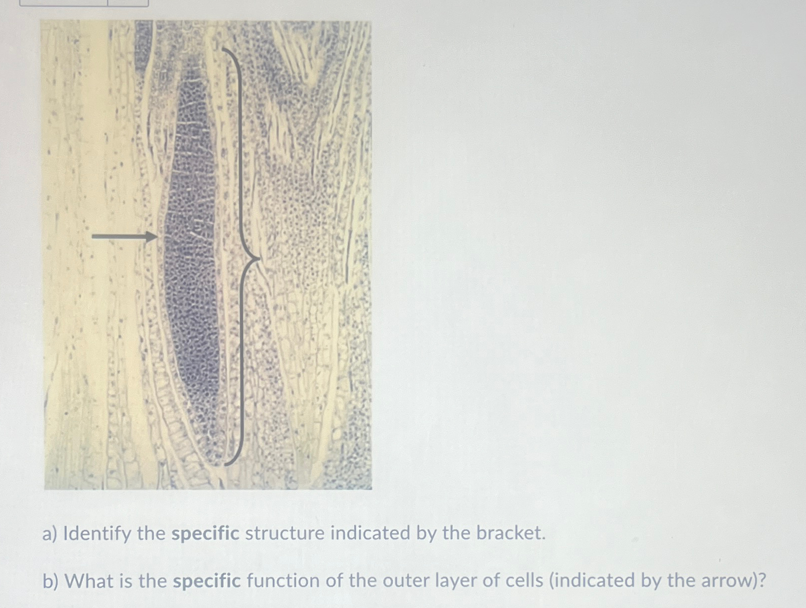 a) ﻿Identify the specific structure indicated by the | Chegg.com