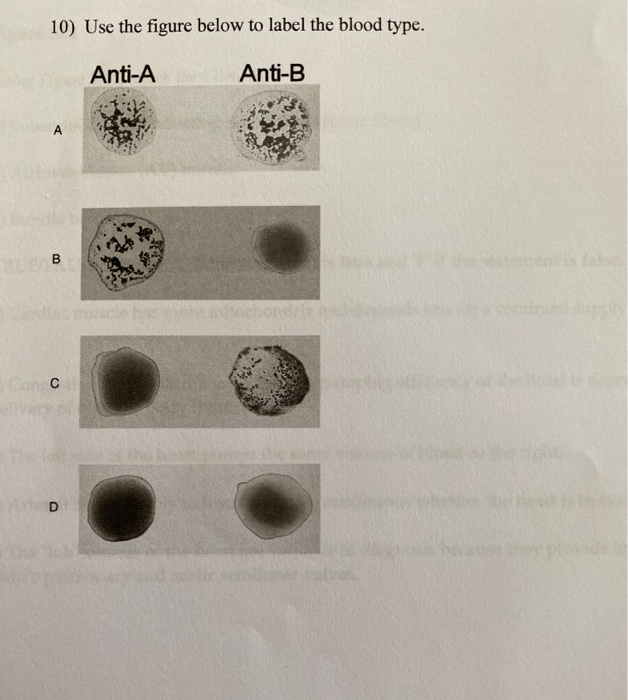 Solved 10) Use the figure below to label the blood type. | Chegg.com