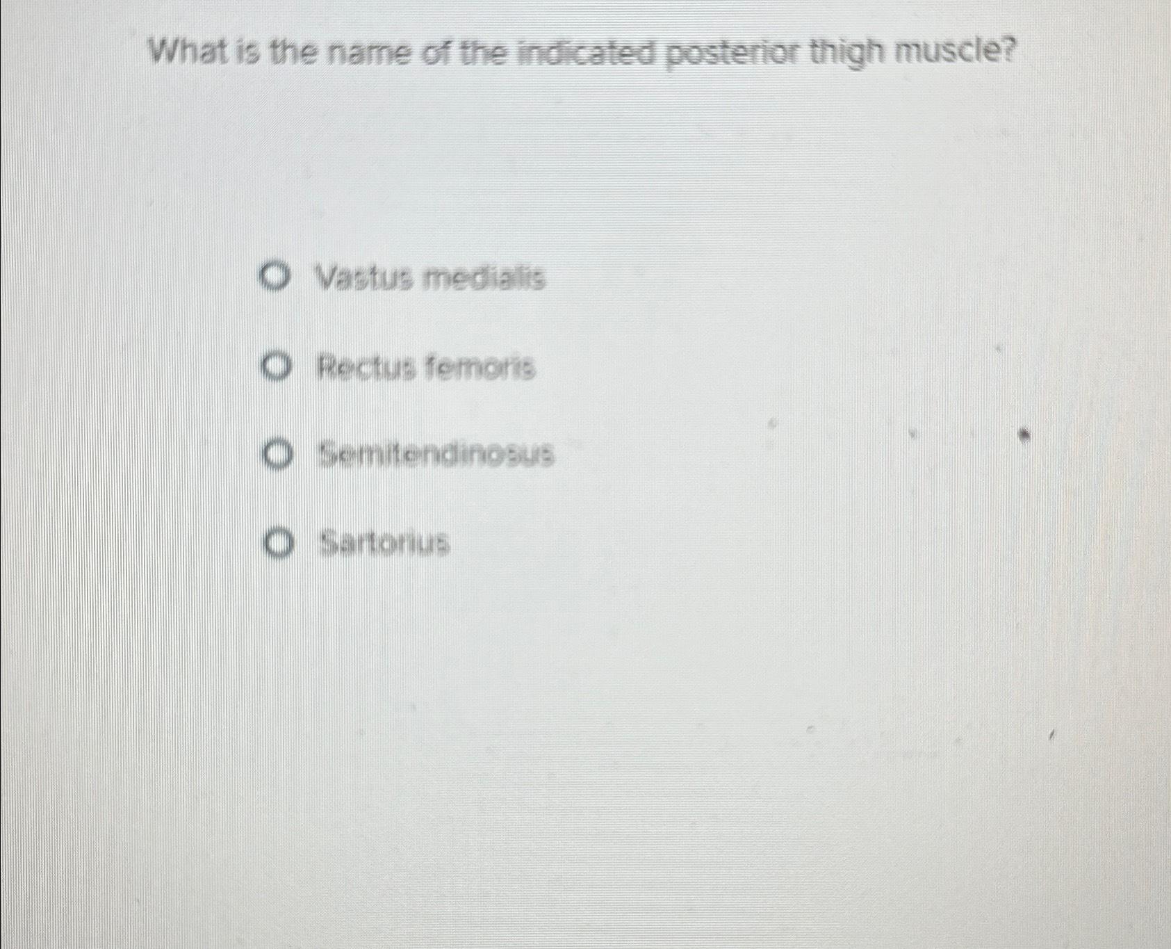 Solved What is the name of the indicated posterior thigh | Chegg.com