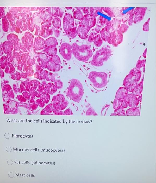Solved What are the cells indicated by the arrows? | Chegg.com
