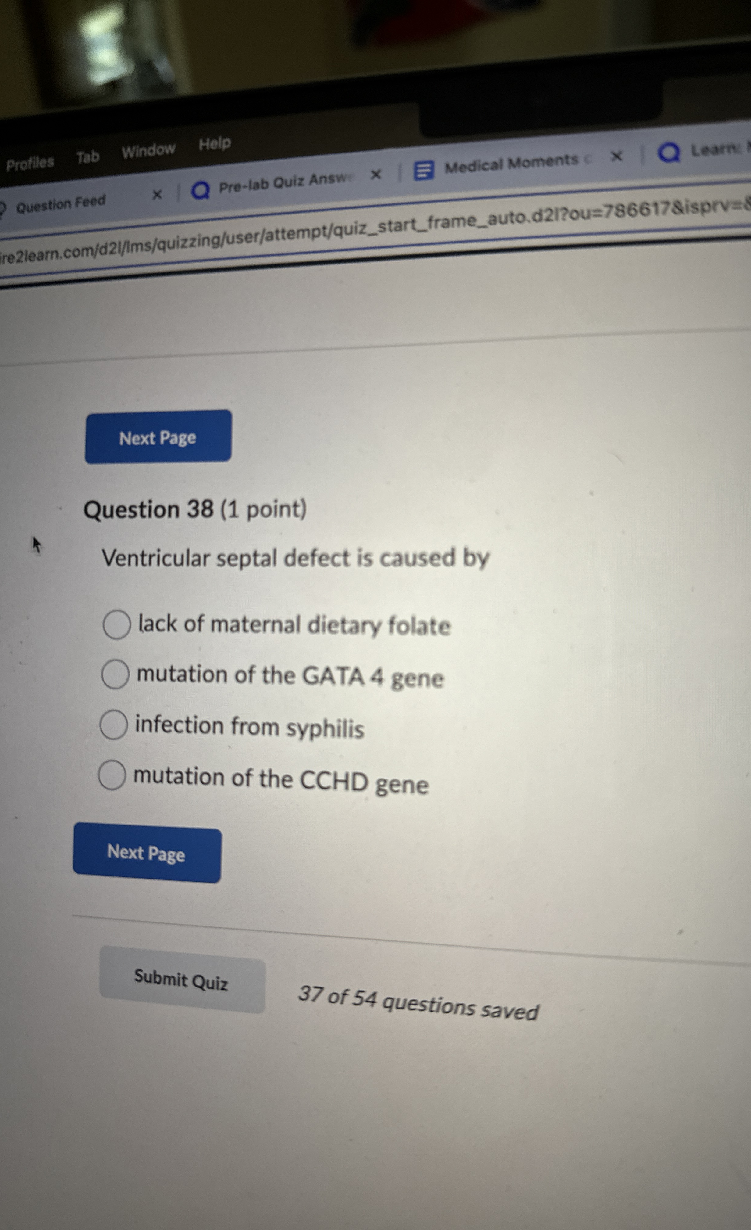 Solved Question 38 (1 ﻿point)Ventricular septal defect is | Chegg.com