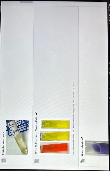 Solved Nutrient Agar, Culture Growth Gram stain Crystal | Chegg.com