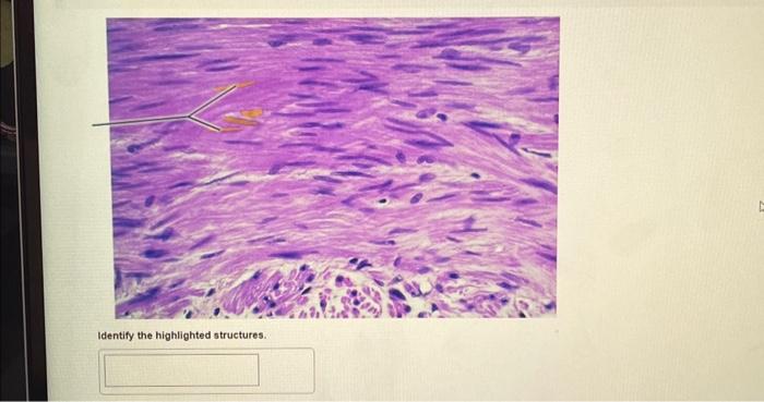 Solved Identify the highlighted structures. Identify the | Chegg.com