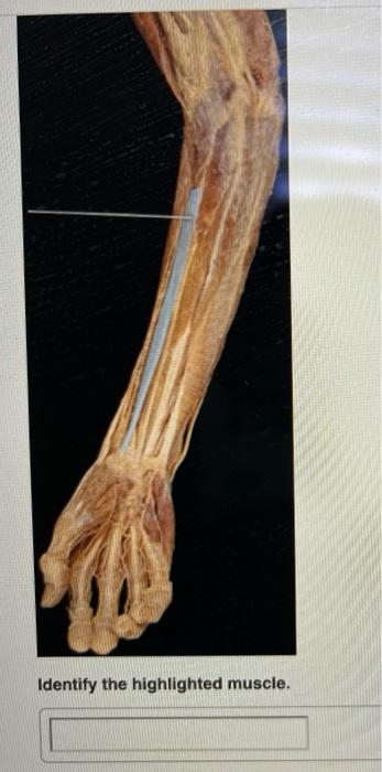 Solved Identify the highlighted muscle. The highlighted | Chegg.com Solved Identify the highlighted muscle. The highlighted | Chegg.com