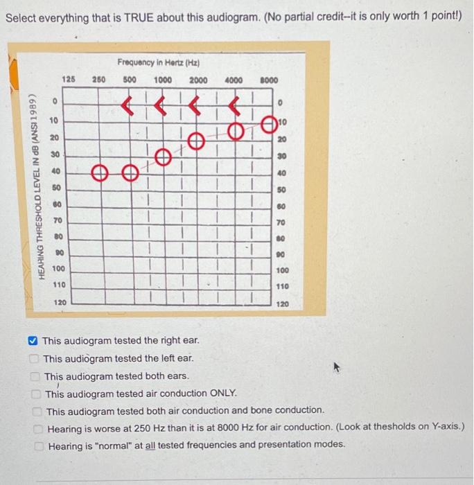 Solved Select everything that is TRUE about this audiogram. | Chegg.com