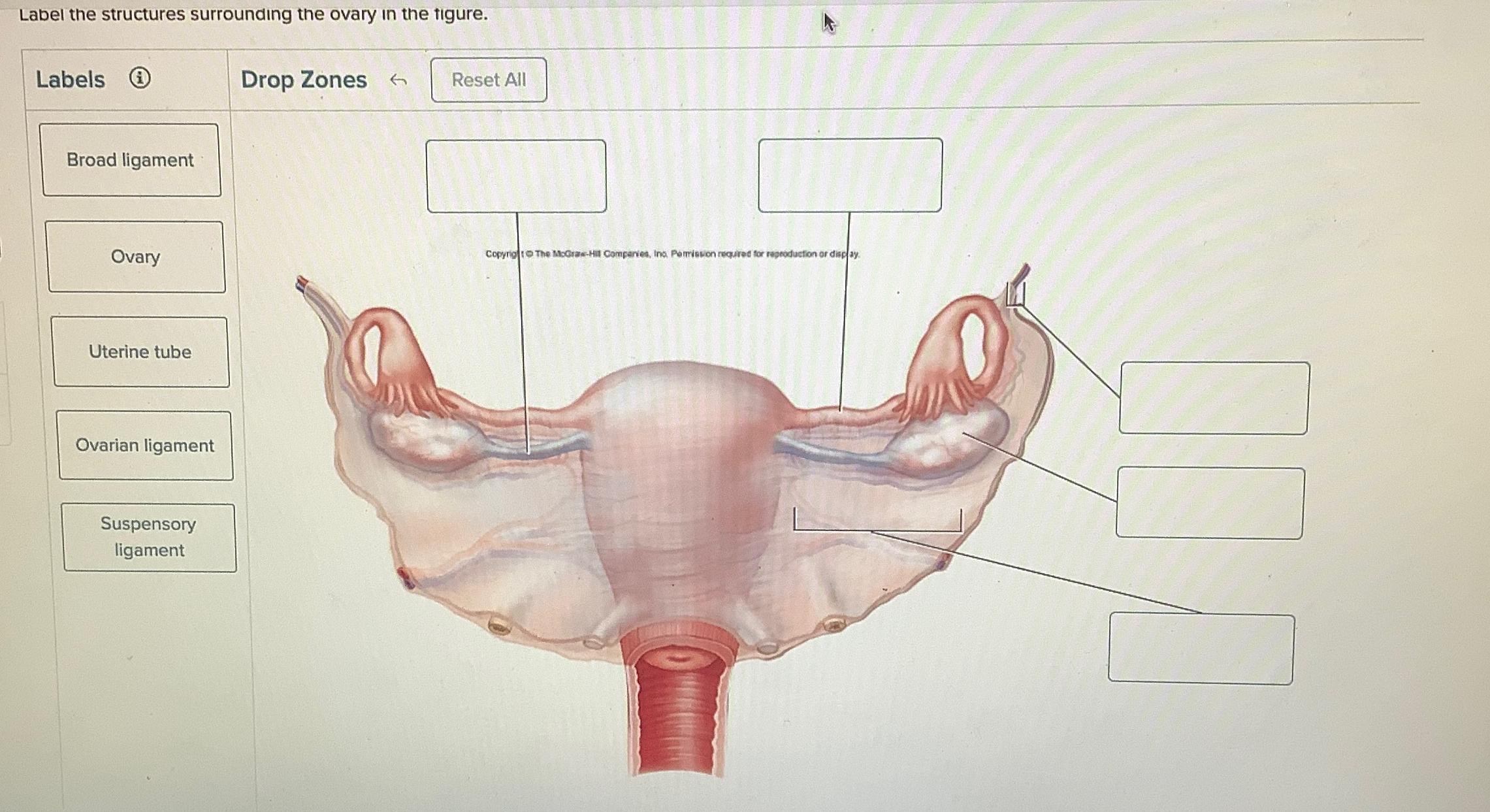 Solved Label the structure surrounding the ovary in the | Chegg.com