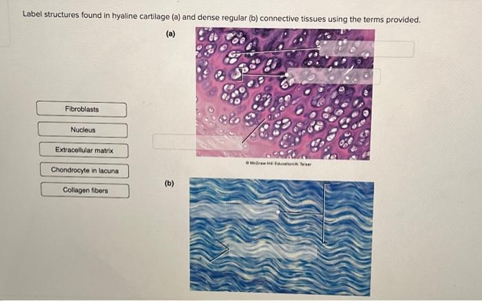 Label structures found in hyaline cartilage (a) and | Chegg.com Label structures found in hyaline cartilage (a) and | Chegg.com