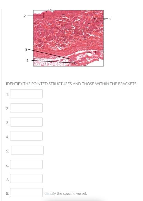 2 3 IDENTIFY THE POINTED STRUCTURES AND THOSE WITHIN | Chegg.com