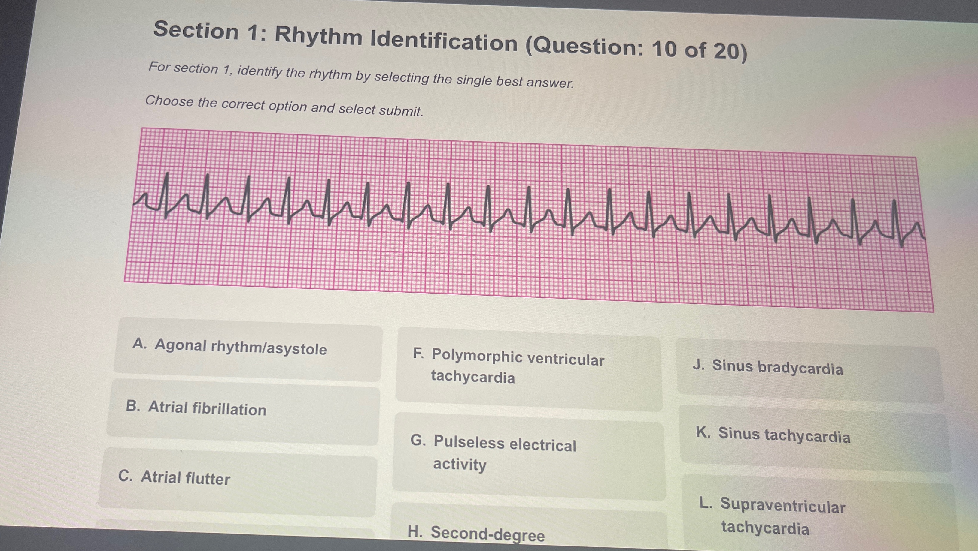 Solved Section 1: Rhythm Identification (Question: 10 ﻿of | Chegg.com