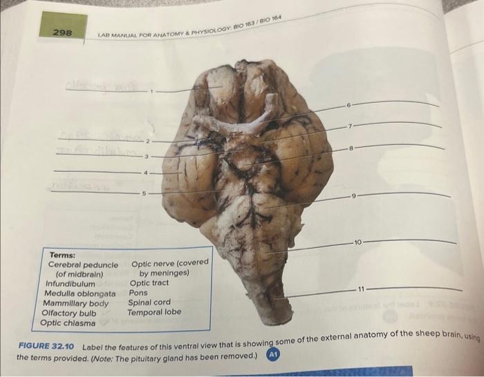 Solved Laboratory Manual for Human Anotomy \& Physlology | Chegg.com