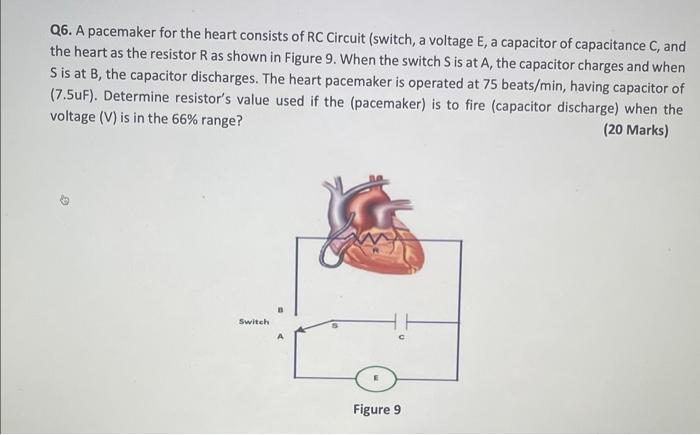 Solved Q6. A pacemaker for the heart consists of RC Circuit | Chegg.com