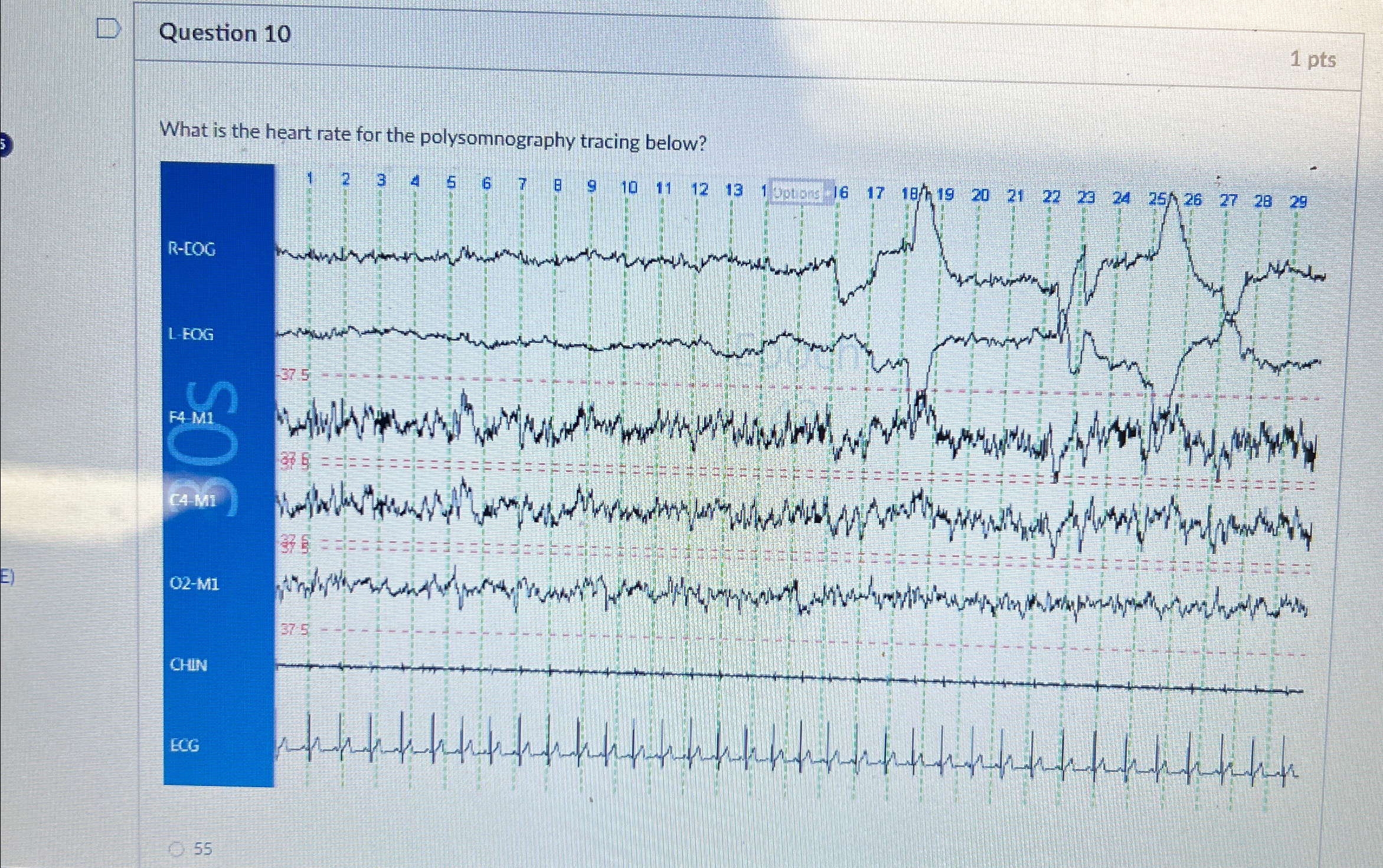 Solved Question 101 ﻿ptsWhat is the heart rate for the | Chegg.com