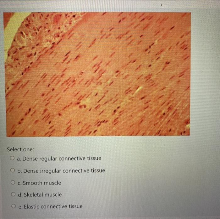 Dense Regular Connective Tissue Vs Smooth Muscle