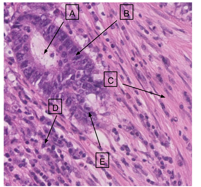Solved Label and explain the histology of resection specimen | Chegg.com