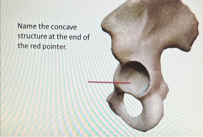 Solved Name the concave structure at the end of the red | Chegg.com