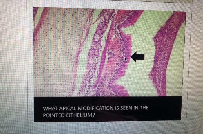 Solved WHAT APICAL MODIFICATION IS SEEN IN THE POINTED | Chegg.com