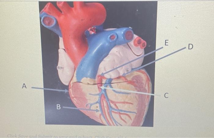 Solved identify the coronary vessels | Chegg.com