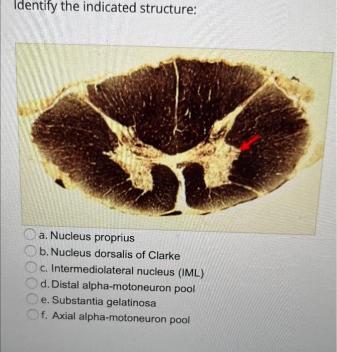 Solved Identify the indicated structure: a. Nucleus proprius | Chegg.com