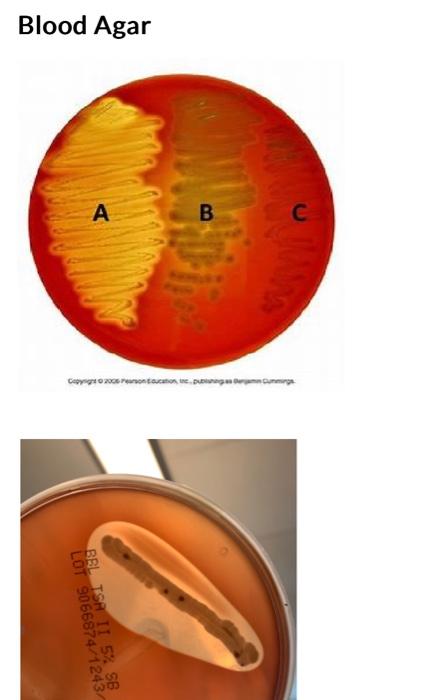 EXERCISE 14: BLOOD AGAR PLATE(BAP) Complete the table | Chegg.com
