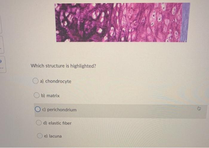 Solved Which structure is highlighted? a) chondrocyte b) | Chegg.com