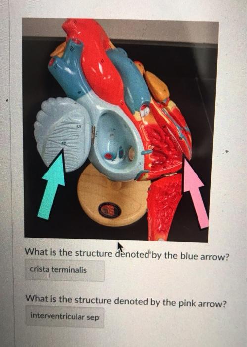 Solved What is the structure denoted by the blue arrow? | Chegg.com