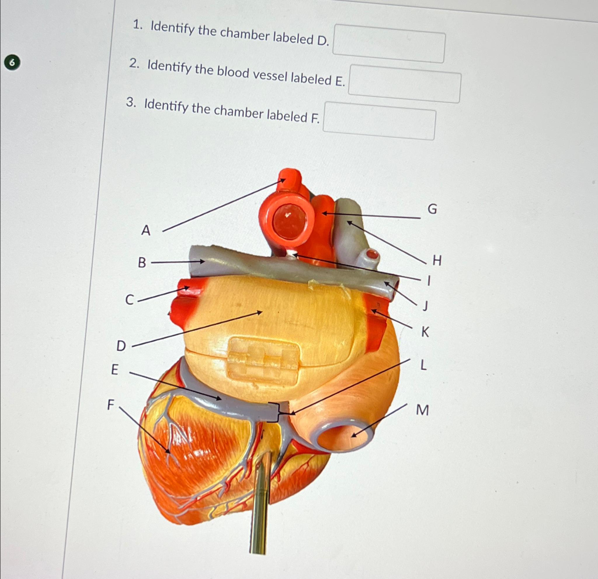 Solved Identify the chamber labeled D.Identify the blood | Chegg.com Solved Identify the chamber labeled D.Identify the blood | Chegg.com