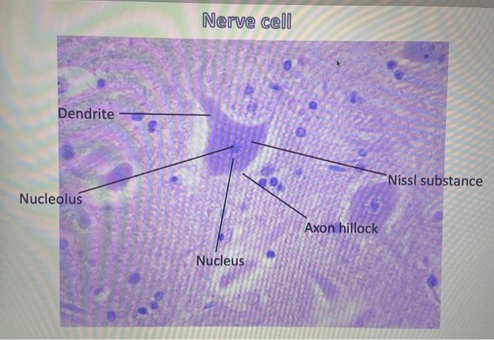 Solved Identify the following features in the cheek cells | Chegg.com