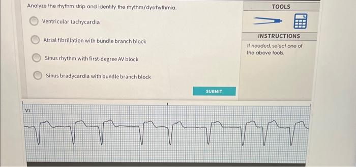 Solved Analyze the rhythm strip and identify the | Chegg.com