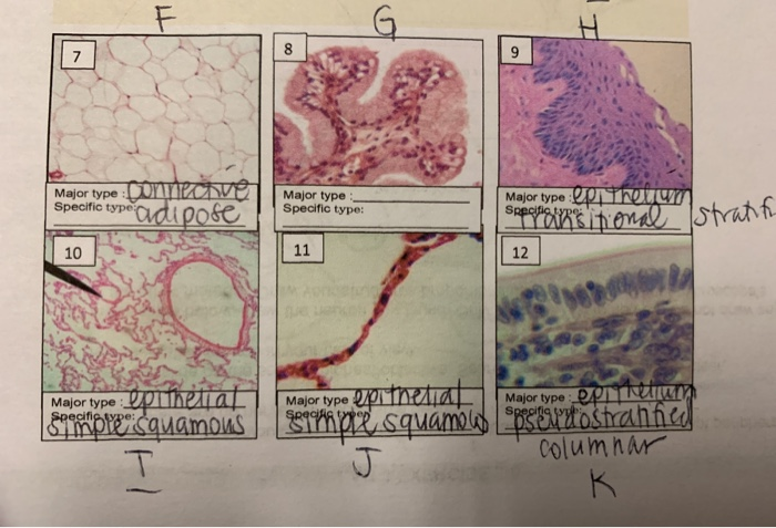 Solved MARKED DETAILS A 1 Name the major types of tissue: 1) | Chegg.com