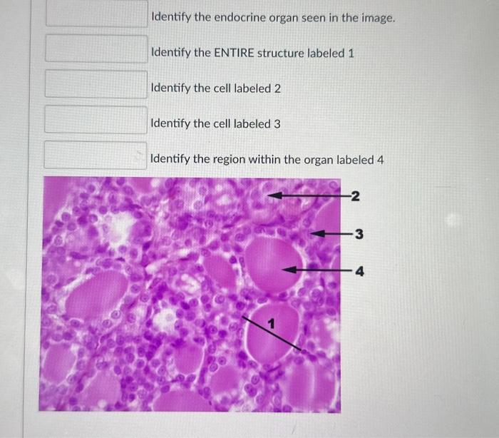 Solved Identify the endocrine organ seen in the image. | Chegg.com