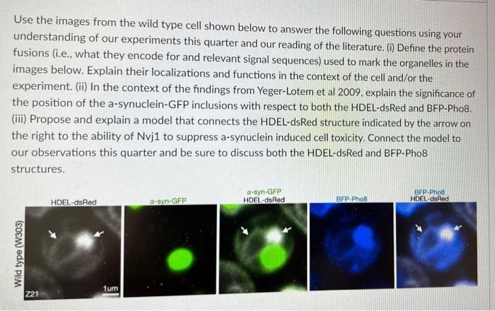 Solved Use the images from the wild type cell shown below to | Chegg.com