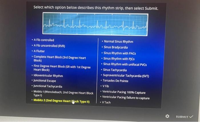 Solved Select which option below describes this rhythm | Chegg.com