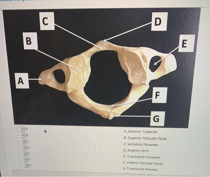 Solved с E А A. Inferior articular facet B. Transverse | Chegg.com