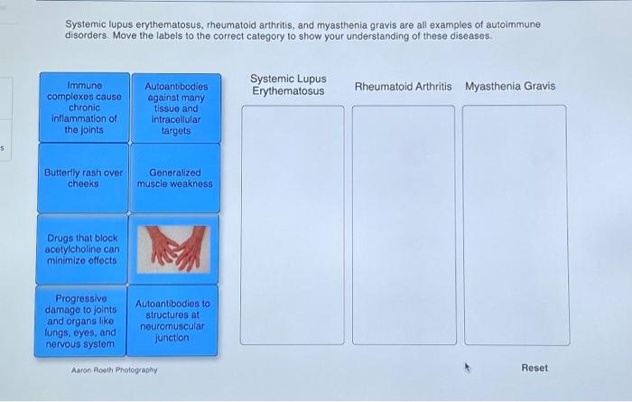 S Systemic lupus erythematosus, rheumatoid arthritis, | Chegg.com