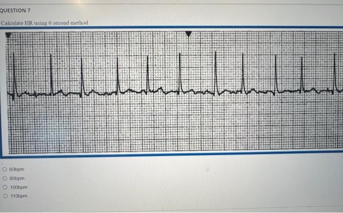Solved QUESTION 7 Calculate HR using 6 second method O 60bpm | Chegg.com