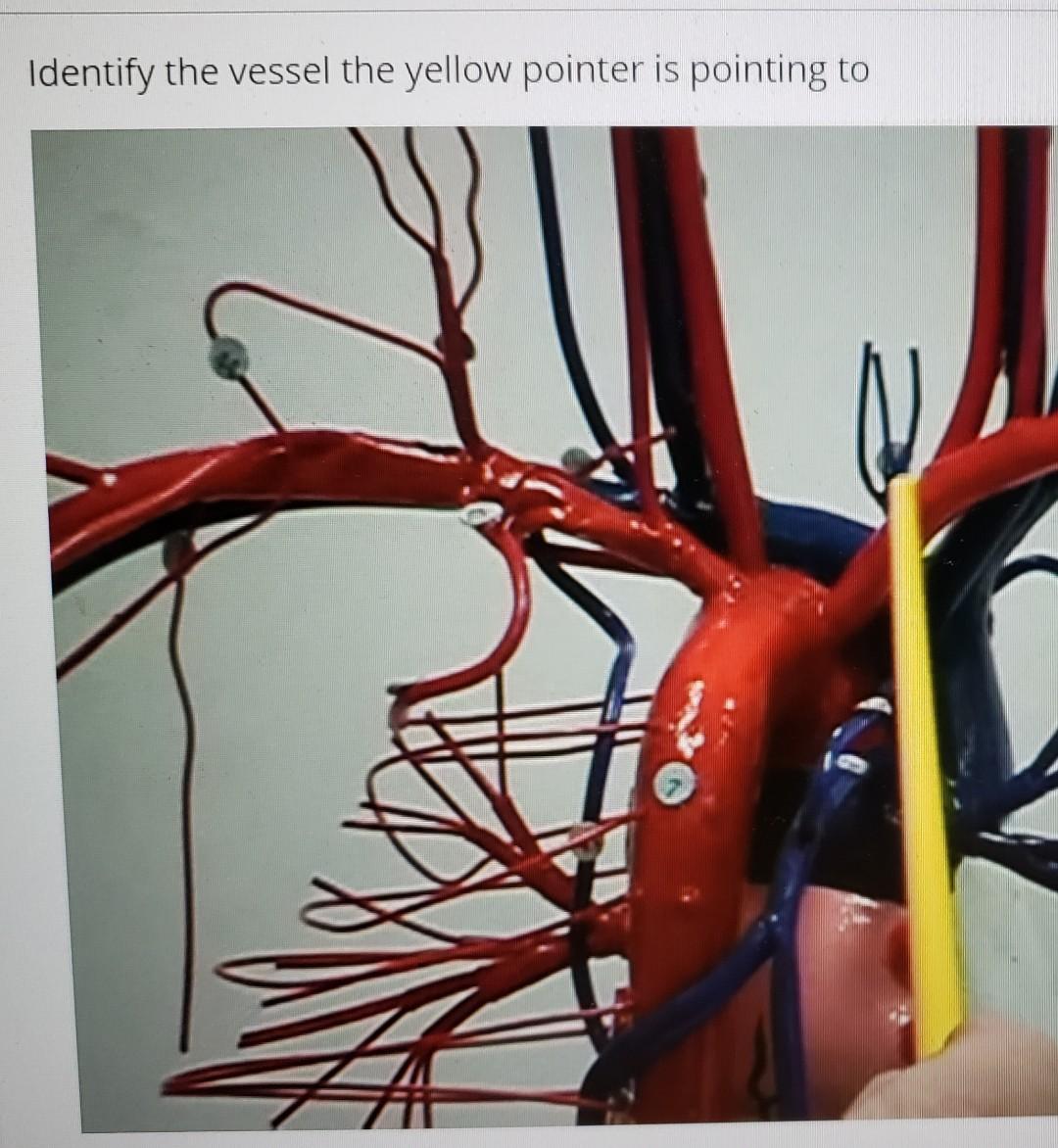 Solved Identify the vessel the yellow pointer is pointing to | Chegg.com
