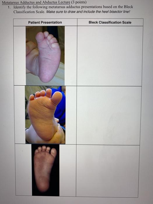 Solved Metatarsus Adductus and Abductus Lecture (3 points) | Chegg.com