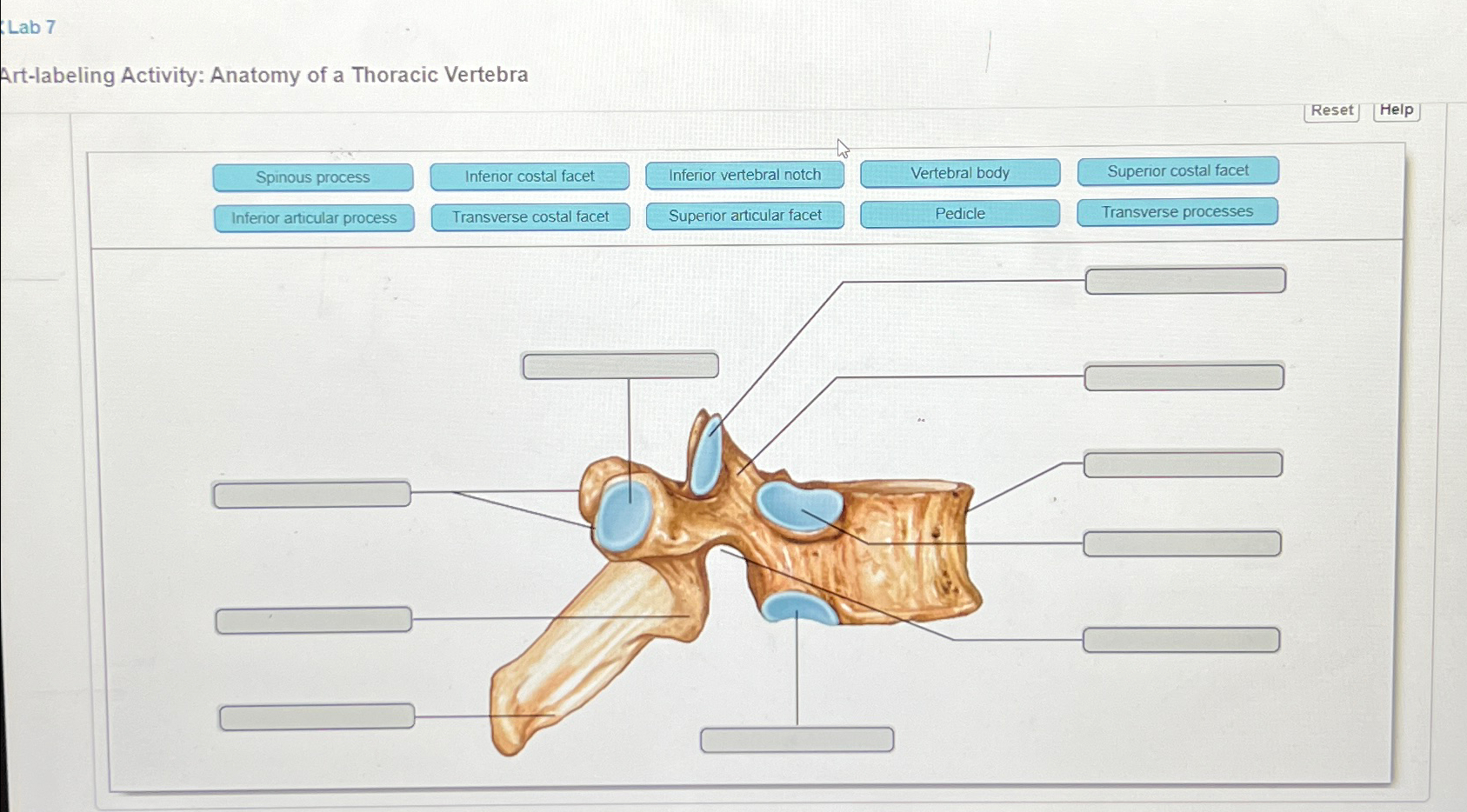 Solved Lab 7Art-labeling Activity: Anatomy of a Thoracic | Chegg.com