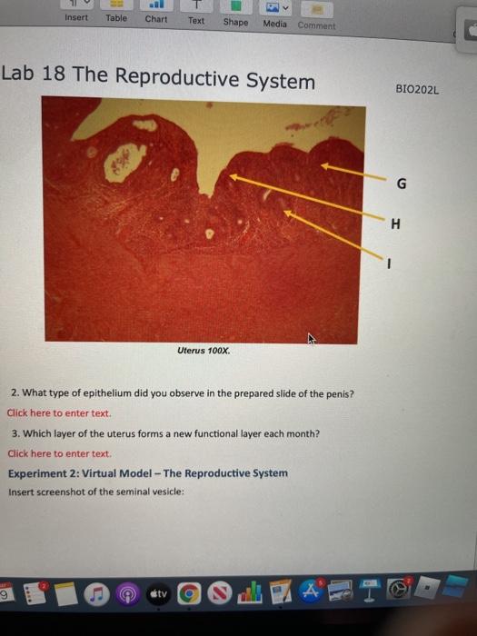 Solved Experiment 1: Microscopic Anatomy of the Reproductive | Chegg.com